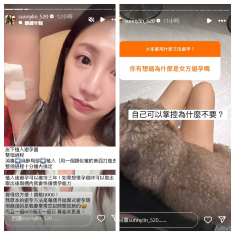 林采緹認了「不愛男友戴套」！她砸萬元裝避孕器 高EQ回嗆：掌控自己有錯嗎 | 娛樂 | CTWANT