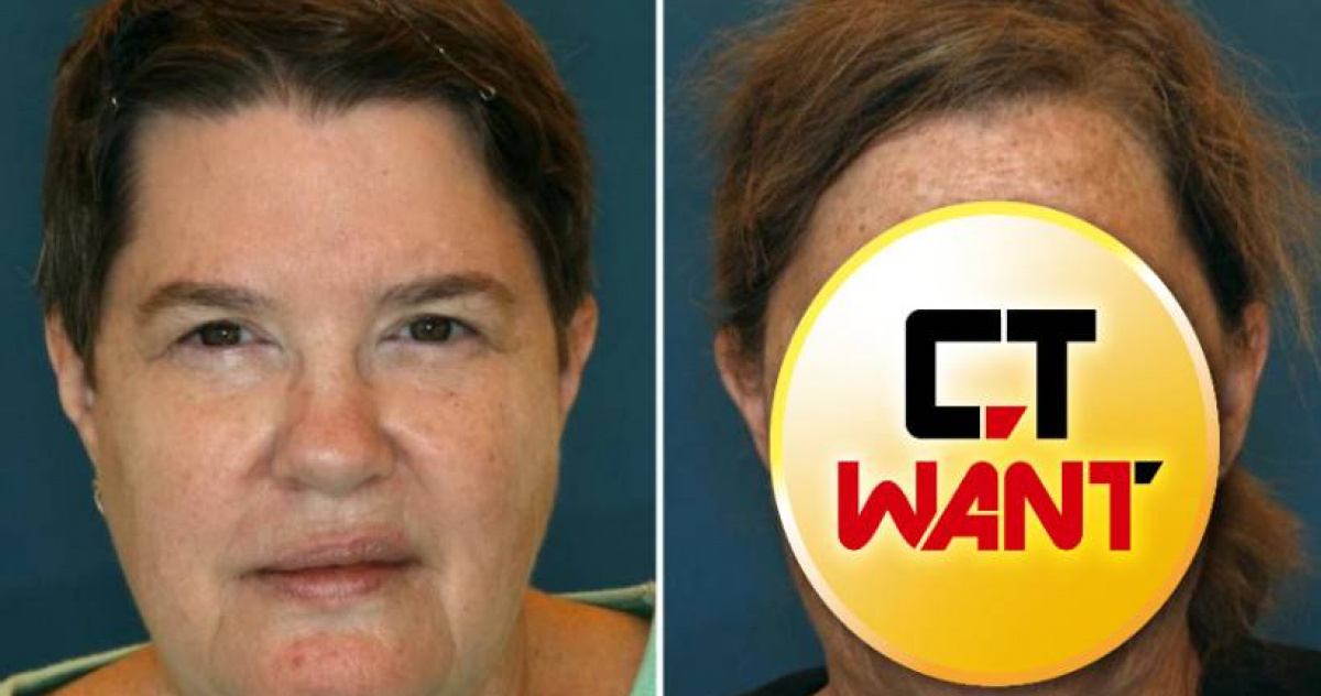 雙胞胎姊妹外表差11歲 她抽菸16年狂曬太陽「結果超嚇人」 | 生活 | CTWANT