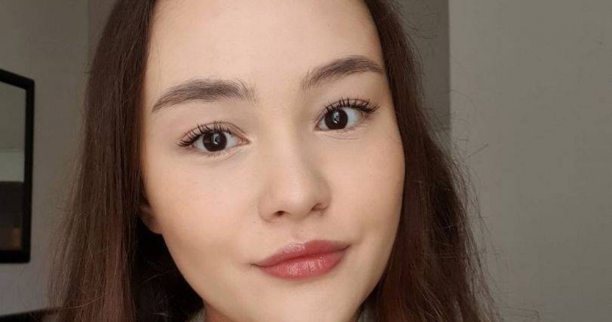 濕疹太嚴重「被誤會自殘」 25歲正妹嘆：沒人敢靠近我 | 國際 | CTWANT