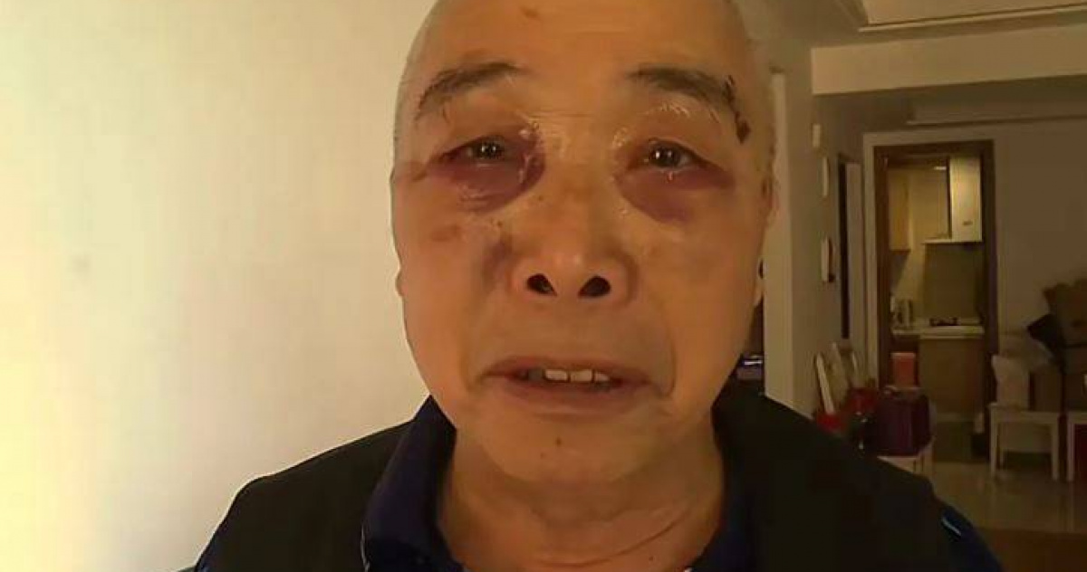 7旬翁出門散步被拉去割眼袋！女兒衝診所接人「來不及了」 負責人回應 | 國際 | CTWANT