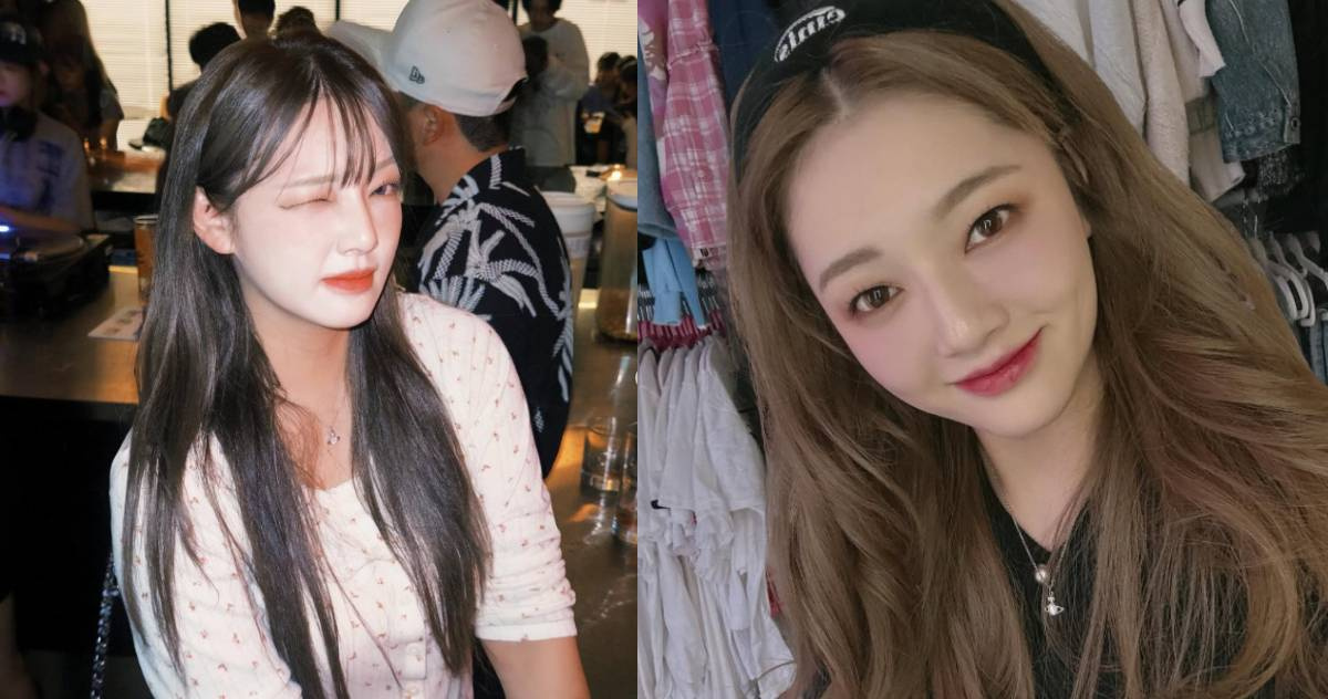 YTR在韓國「拒絕跟陌生男回家」被痛毆！ 傷照曝：全身瘀青、手指骨折 | 娛樂 | CTWANT