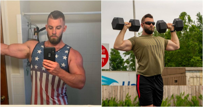 美國陸軍中士網購藥物對抗禿頭 副作用卻讓他GG縮水變形、性慾消失 | 國際 | CTWANT