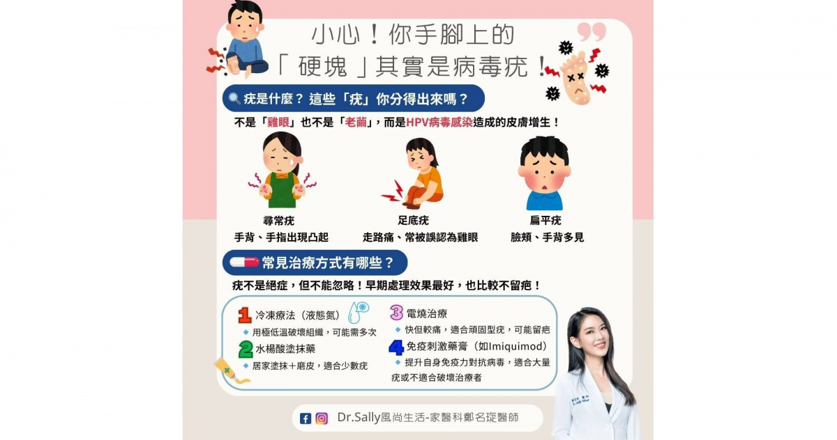赤腳淋浴恐惹「疣」上身 專業醫提醒「3病毒疣」常被錯認 | 生活 | CTWANT