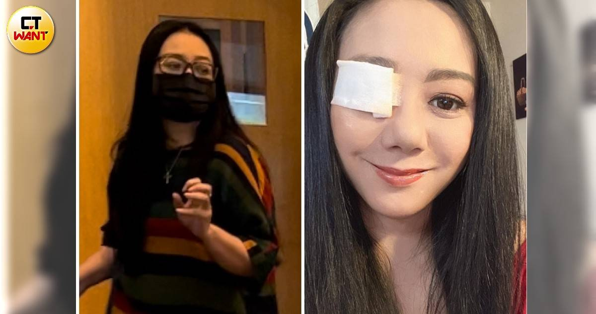 娛樂報報／捕獲野生高慧君 右眼術後恢復良好還能血拼 | 娛樂 | CTWANT