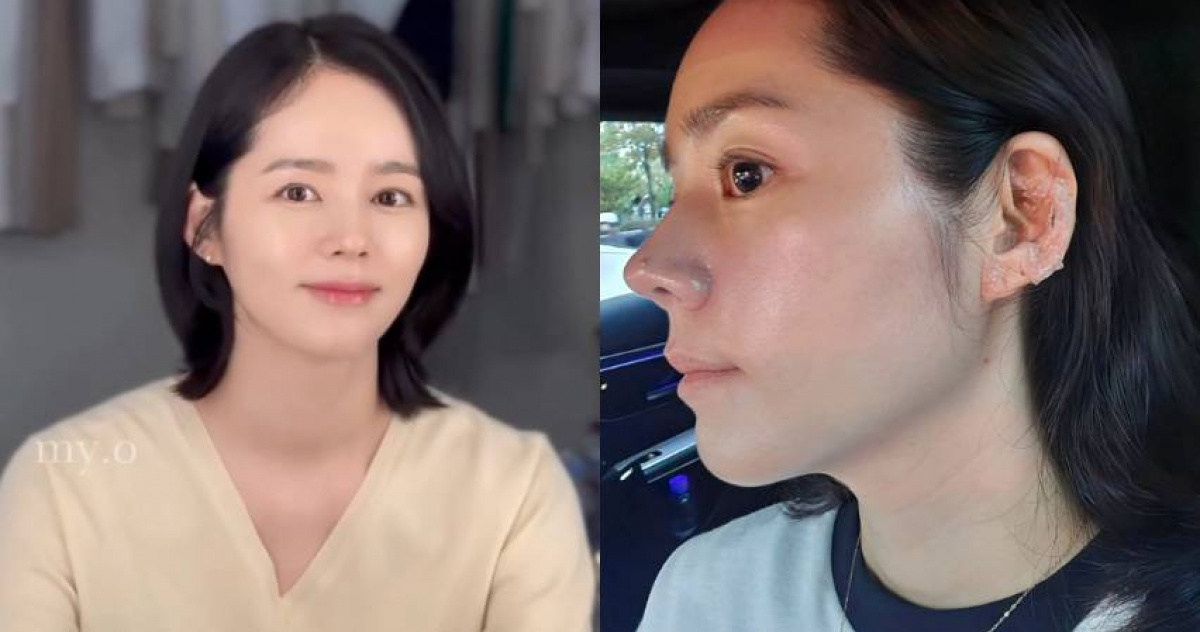 不吃麵食、速食、甜食！「韓國第一美女」韓佳人靠「食療」養出最高級的素顏美肌 | 漂亮 | CTWANT