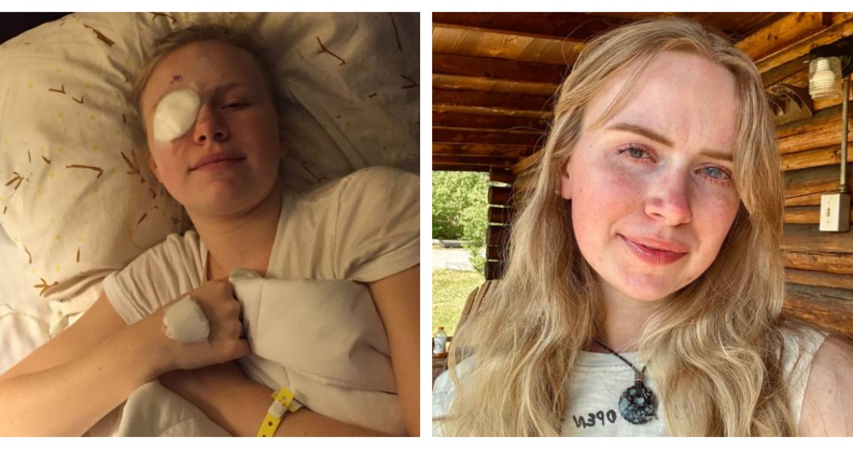 她一覺醒來陷黑暗！26歲女子幼年關節炎併發眼疾 歷經24次手術仍陷「隨機失明」困境 | 國際 | CTWANT