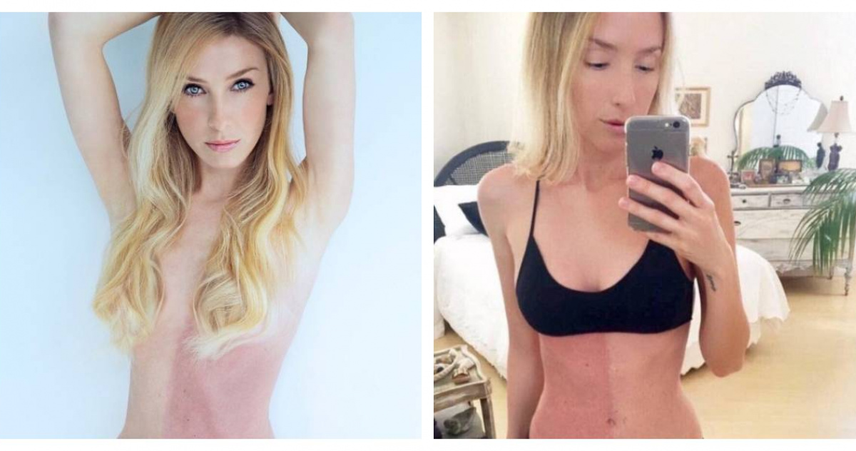 她「吃了」雙胞胎妹妹！女模皮膚2截色確認為「嵌合體」 竟有2組DNA | 國際 | CTWANT