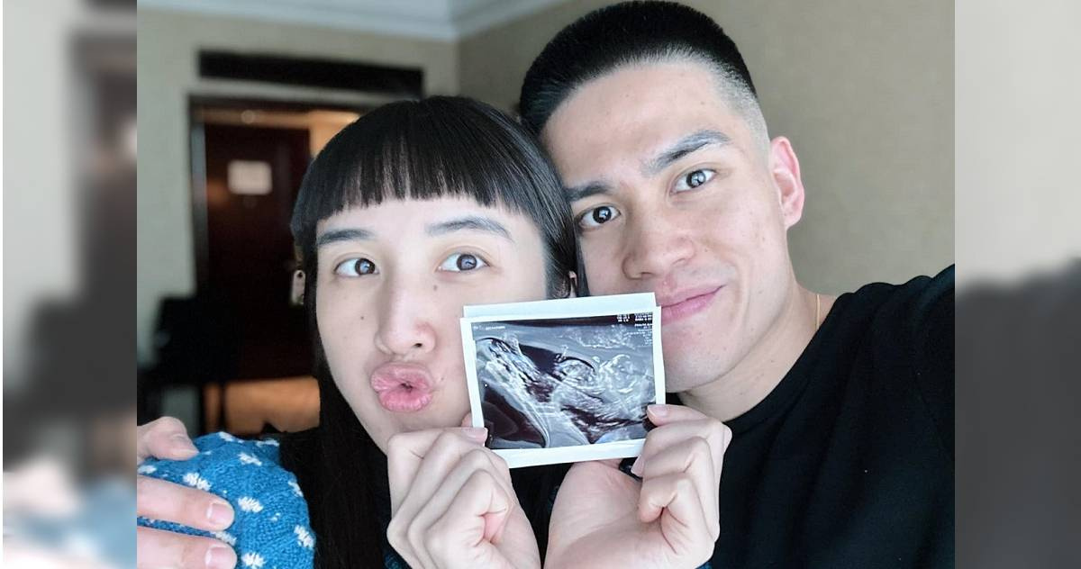 「台灣隊長」陳盈駿要當爸了！ 愛妻郭佳紋曬「超音波照」曝喜訊 | 生活 | CTWANT
