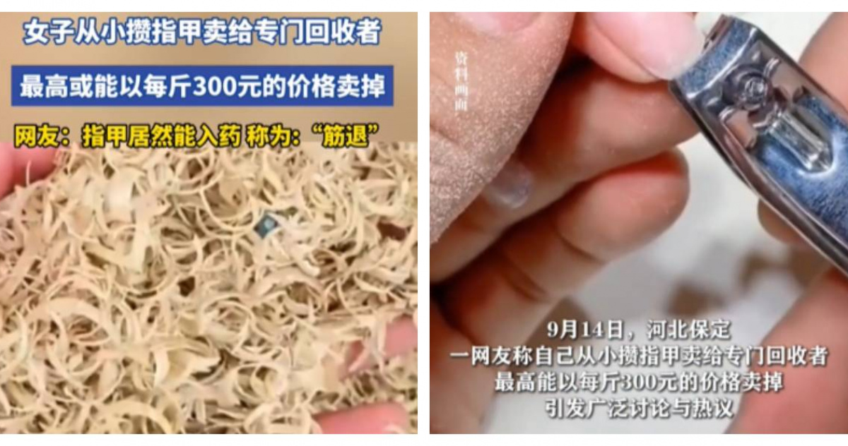 指甲能當傳統藥材？女子從小收集販售「最高1320元台幣」 專家揭入藥風險 | 國際 | CTWANT