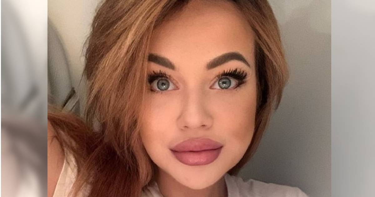 女子狂喝烈酒斷片！ 醒來腿脹疼痛難耐險些截肢 | 國際 | CTWANT