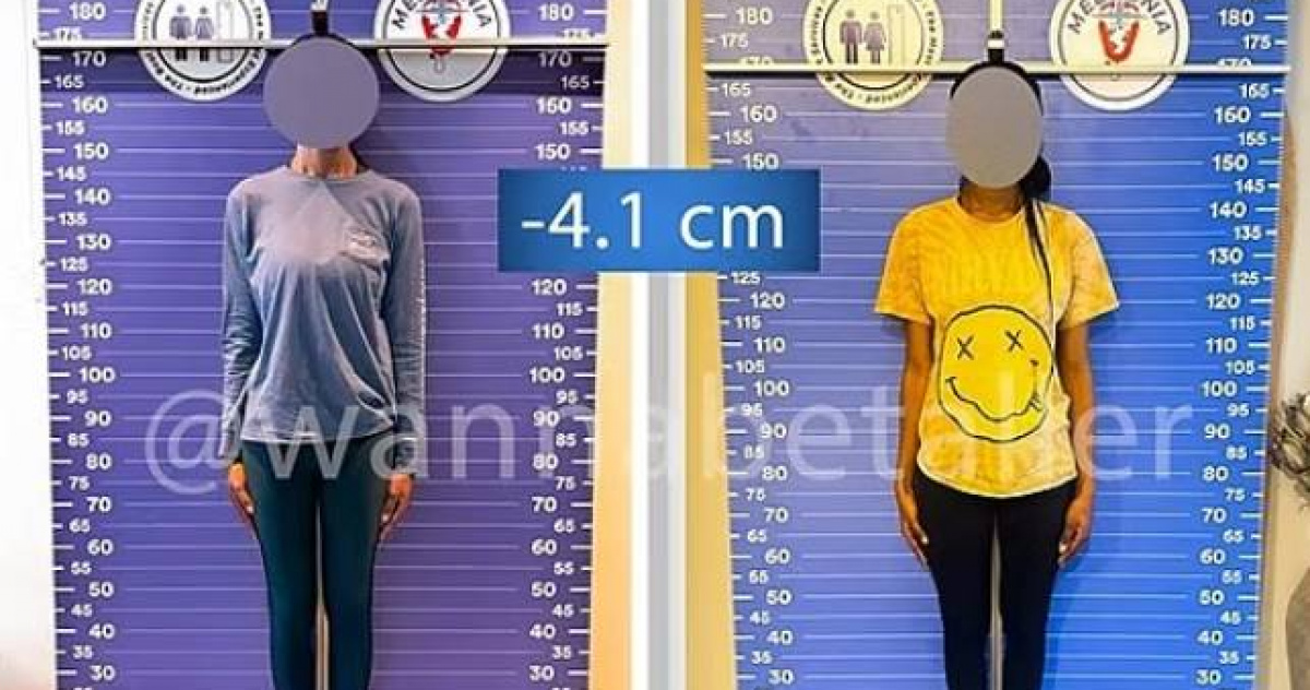 長腿妹也想變「嬌小」！ 女性掀起赴土耳其削腿縮高整形潮 | 國際 | CTWANT