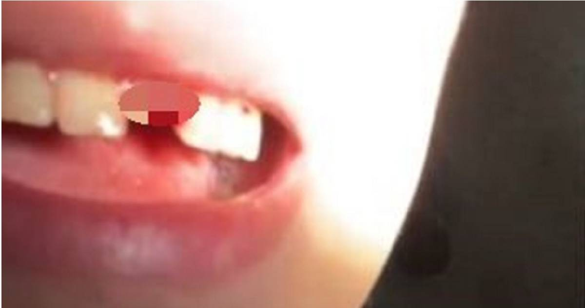 女子打瞌睡躺著玩手機⋯下秒滿口鮮血 半顆門牙竟被砸斷 | 國際 | CTWANT