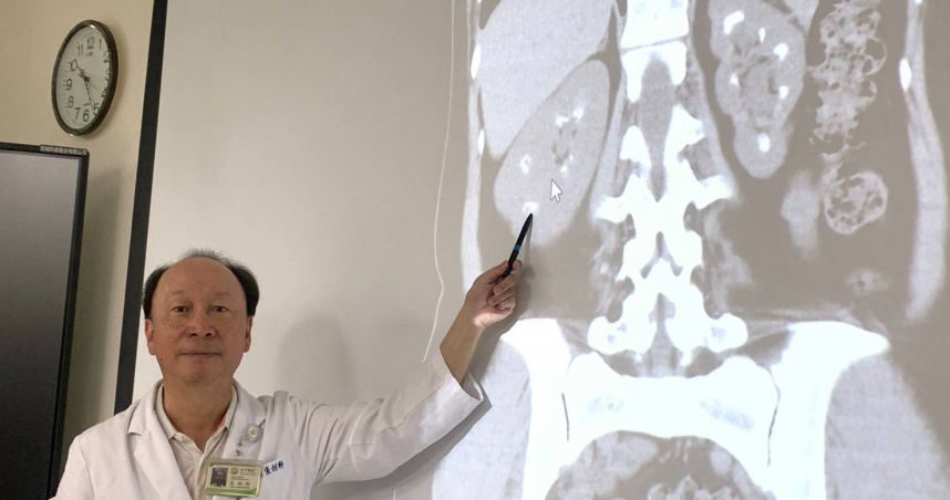 台中OL「2年5度腎結石」腰痛就醫 醫揪雙腎像「滿天星」原因曝光 | 生活 | CTWANT