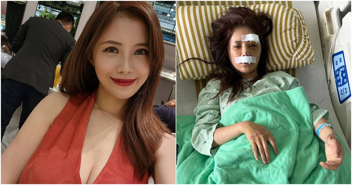 女主播「車禍撞殘臉」悲認：狀況一度很糟 復工「靠化妝遮醜」長相曝光 | 娛樂 | CTWANT