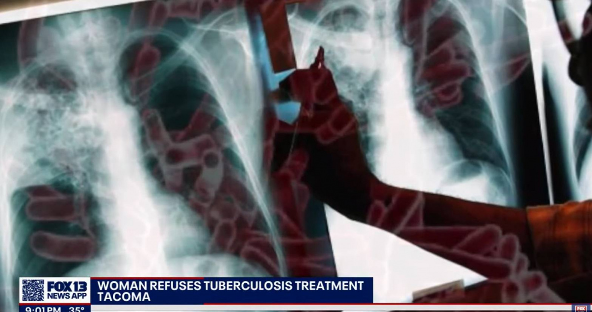 Fighting the Spread of Tuberculosis: The Story of a Woman who Refused ...