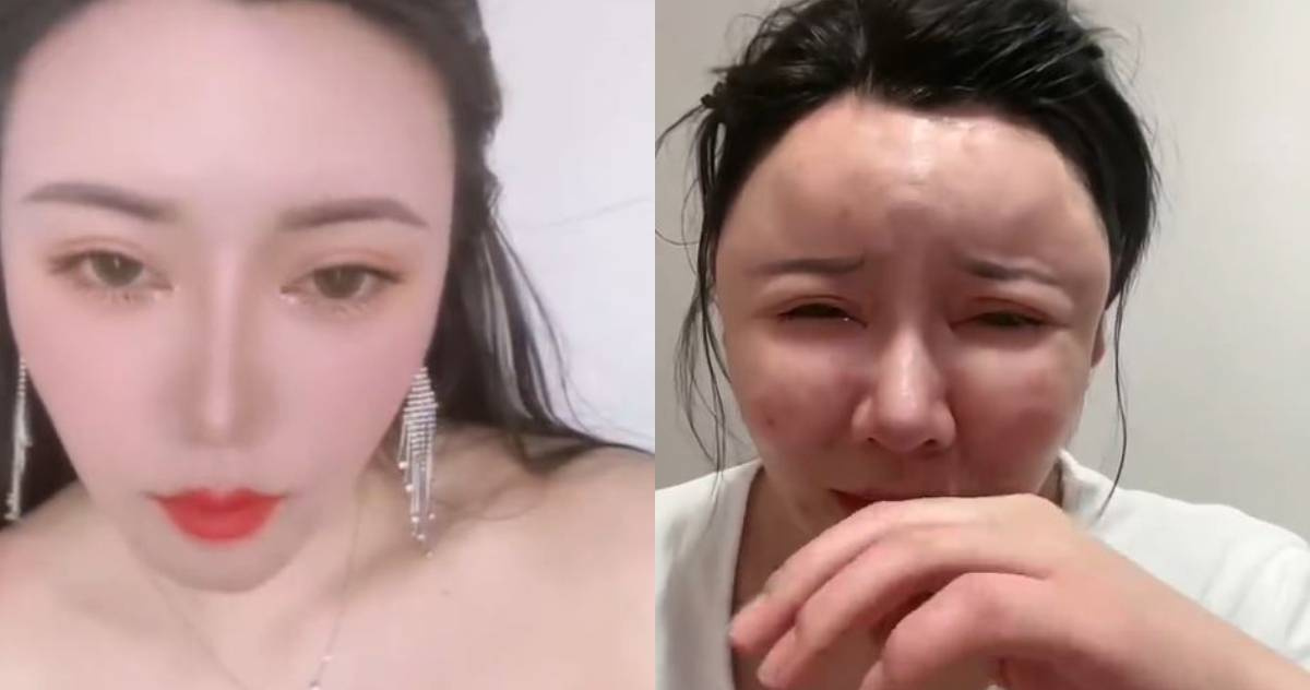 驚悚！陸正妹打生長因子想變更美 臉部「完全饅化」慘成面具人 | 生活 | CTWANT