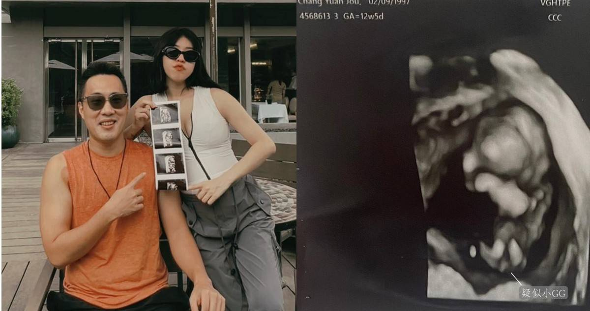 余祥銓公布胎兒超音波照 看到小GG卻有意外驚喜 | 娛樂 | CTWANT