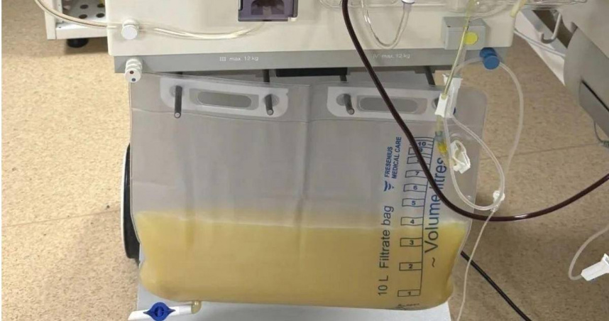 40歲總經理應酬多「血液變奶白色」 就醫被送進ICU！醫：易變成重症 | 國際 | CTWANT