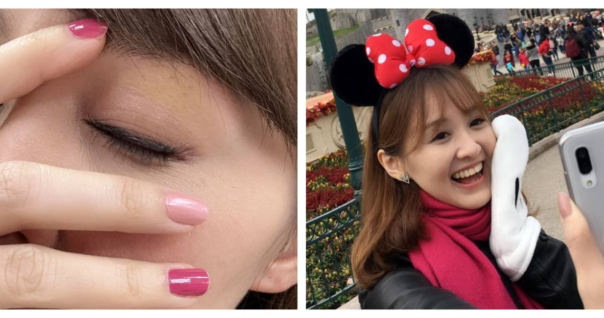 美女主播曬眼窩淤青照認「被家暴」 她感嘆：沒想過會被下重手 | 娛樂 | CTWANT