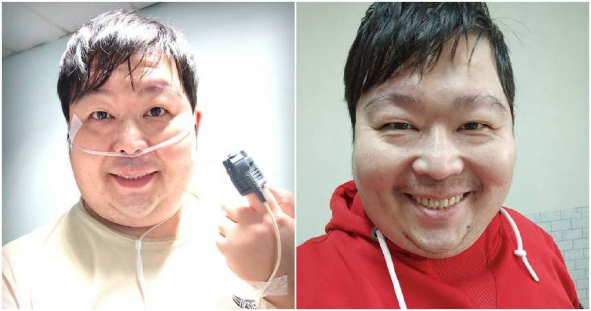 山豬罹「紅斑性狼瘡」14年 11大症狀一次看！符合4項快就醫 | 娛樂 | CTWANT