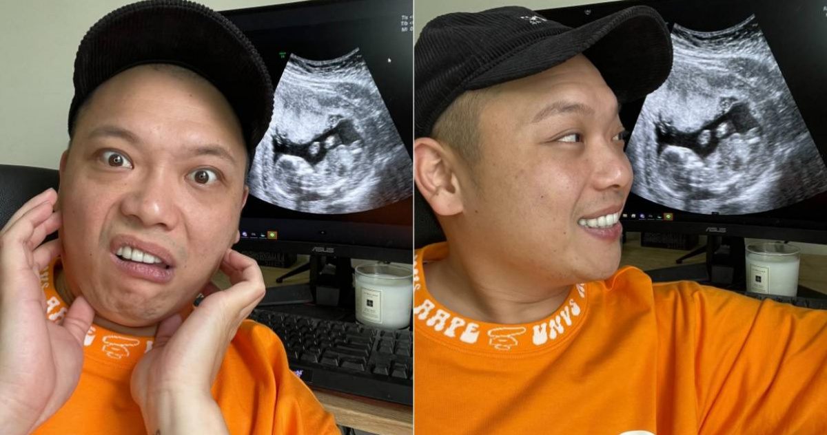 家有喜事1／阿虎宣布當爸陪產檢 準老婆真面目曝光 | 娛樂 | CTWANT