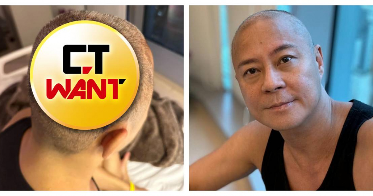 草蜢蔡一傑認了腦瘤！他剃光頭頂「巨大疤痕」近照流出 大喊：給我時間好起來 | 娛樂 | CTWANT
